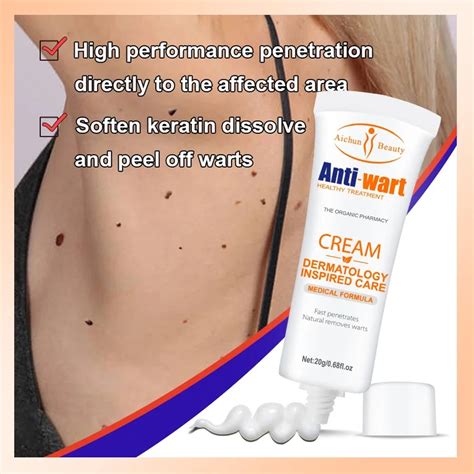 Aichun Beauty Anti Wart Cream 20 Gm Sy Bazzar