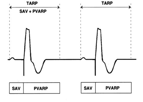 Strategies And Pacemaker Algorithms For Avoidance Of Unnecessary Right Ventricular Stimulation