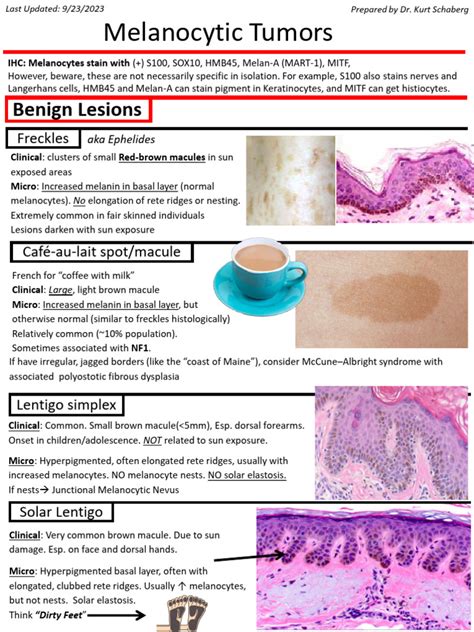 Melanocytic Tumors Pdf Melanoma Epidermis