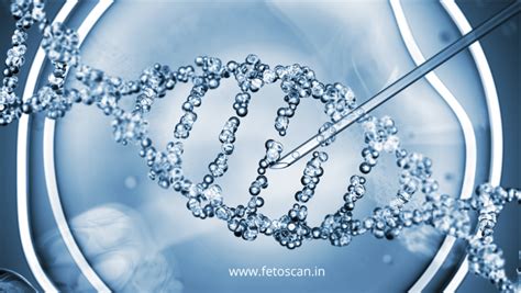 Benefits And Risks Of Prenatal Genetic Testing Fetoscan