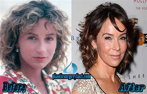 Jennifer Grey Plastic Surgery Before And After Nose Job Jennifer Grey