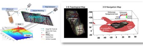 Figure 16 From Review On Vision‐based Tracking In Surgical Navigation Semantic Scholar