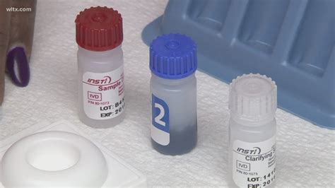free std hiv testing on thursday