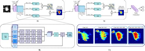 Figure 1 From A Multi Scale Self Attention Network To Discriminate Pulmonary Nodules Semantic