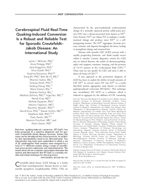 Pdf Csf Rt Quic Is A Robust And Reliable Test For Sporadic Cjd An