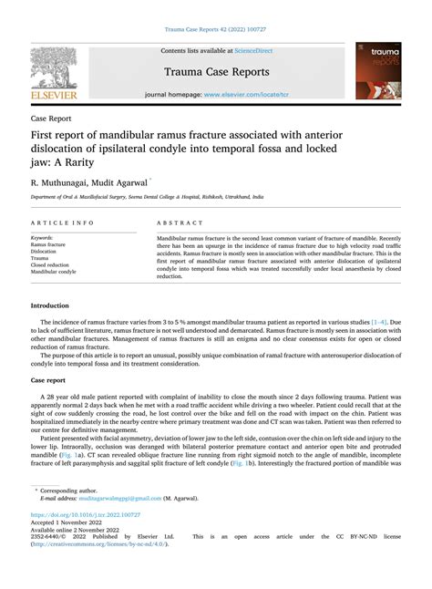 Pdf First Report Of Mandibular Ramus Fracture Associated With
