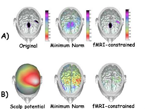 The Upper Row Of The Figure A Presents Three Cortical Current Download Scientific Diagram