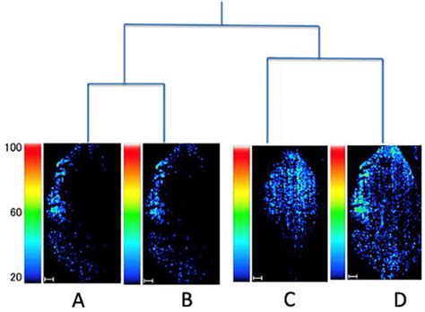 Mass Spectrometry Analysis Using Formalin Fixed Paraffin Embedded Pathological Samples IntechOpen