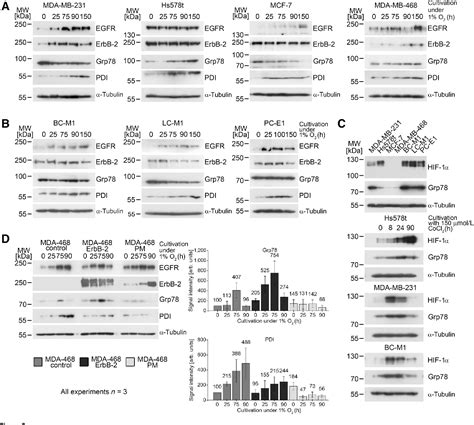 Figure 2 From Disseminated Tumor Cells Persist In The Bone Marrow Of Breast Cancer Patients