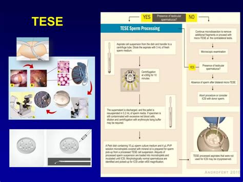 Microdissection Testicular Sperm Extraction Pptx