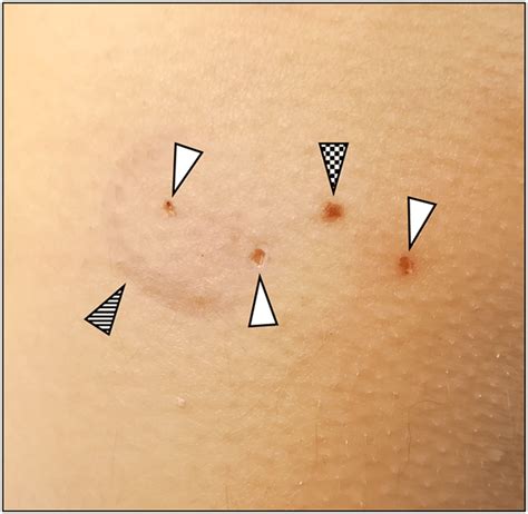 Close Up Photograph Of The Proximal Left Tibia External Inspection Download Scientific Diagram
