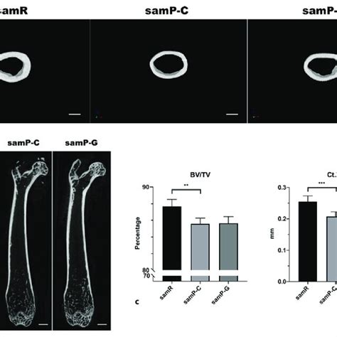 Micro Ct And Quantification Of Bone Microarchitecture In The Femoral Download Scientific