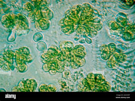 Light Micrograph Of Cyanobacteria Formerly The Blue Green Algae