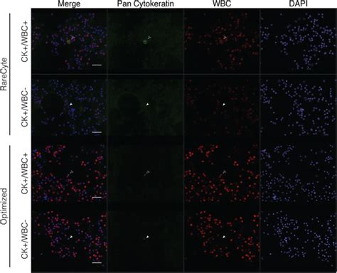 The Optimized Protocol Enhances Detection Of Patient Dtcs Compared To