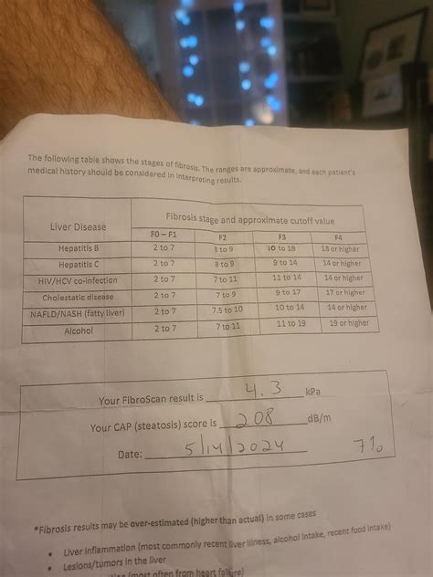 Fibroscan Results Rnafld