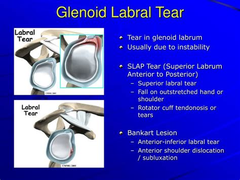 Ppt History And Physical Examination Of The Shoulder Powerpoint
