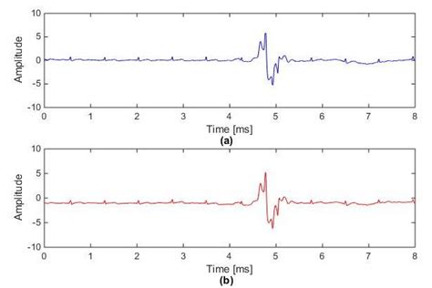 A Noisy Ecg Signal B Denoised Ecg Signal Using Coif4 Download