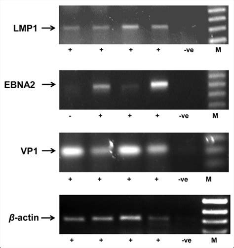 Representative Examples Of Pcr Positive Specimens For The Viral