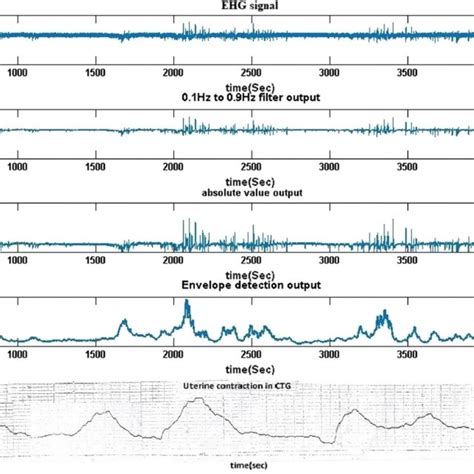 Power Spectrum Of Single Uterine Contraction Portion In Ehg Signal A Download Scientific