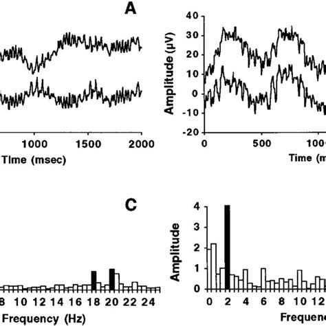 Pattern Reversal Vep To 15 Minute Checks From A Patient With Duane Download Scientific Diagram