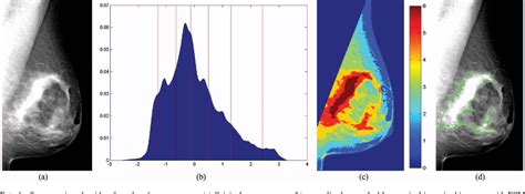 figure 1 from estimation of breast percent density in raw and processed