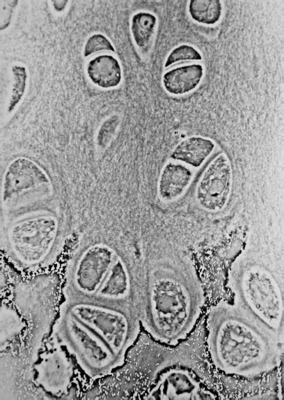 6 4a embryonic and fetal bone formation medicine libretexts