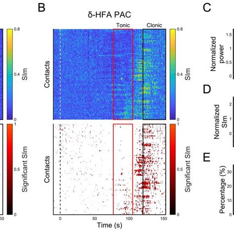 Intracranial Electroencephalography Ieeg Signals High Frequency Download Scientific Diagram
