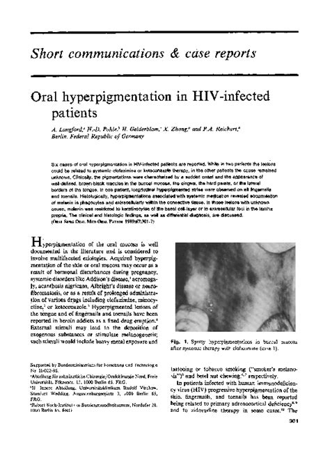 Pdf Oral Hyperpigmentation In Hiv Infected Patients
