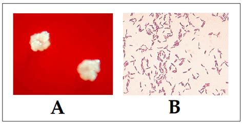 The Pathogenic Role Of Actinomyces Spp And Related Organisms In