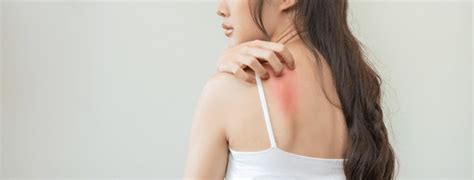 4,998 Asian Woman Itching Images, Stock Photos, 3D objects, & Vectors | Shutterstock
