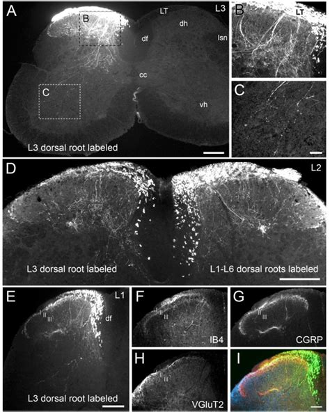 Central Terminals Of Primary Afferent Fibers Detected By Anterograde Download Scientific