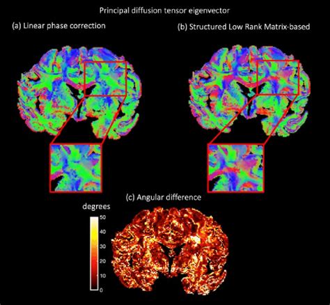 Shows A Coronal View Of The Principal Diffusion Tensor Eigenvector Map