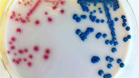 Blue For E Coli Red For Coliforms A Visual Breakthrough In Microbial