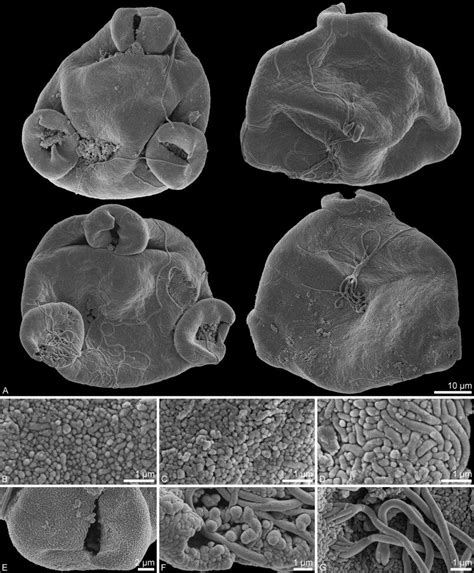 Scanning Electron Microscopy Sem Micrographs Of Fossil In Situ
