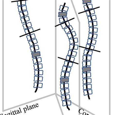 Plane Of Maximum Curvature Pmc Download Scientific Diagram