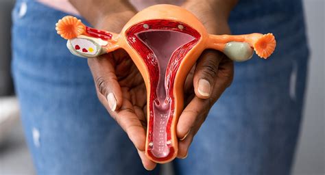 Ovarian Cancer Quiz Doquizzes