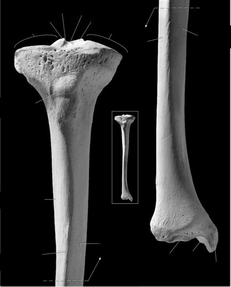 Tibia Diagram Quizlet