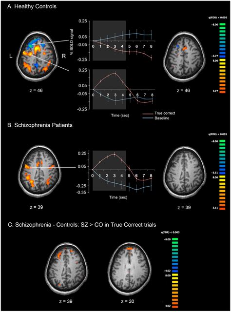 Cortical Activation Patterns During Verbal Wm Maintenance For The Two