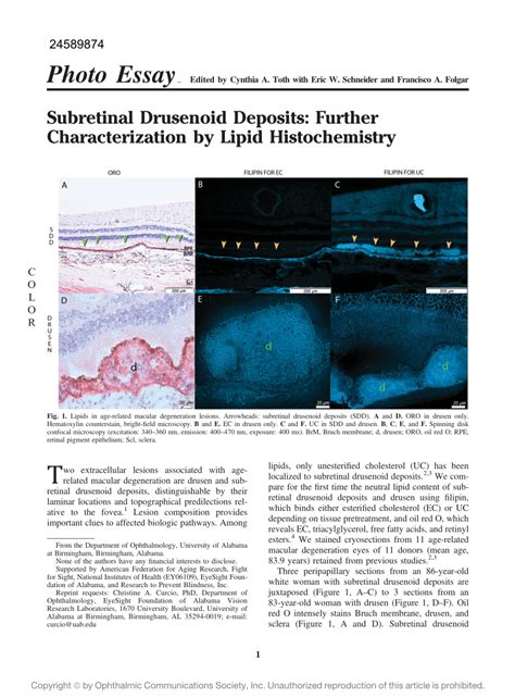 Pdf Subretinal Drusenoid Deposits Further Characterization By Lipid