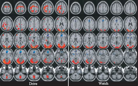 results from the glm based fmri analysis regression increases red
