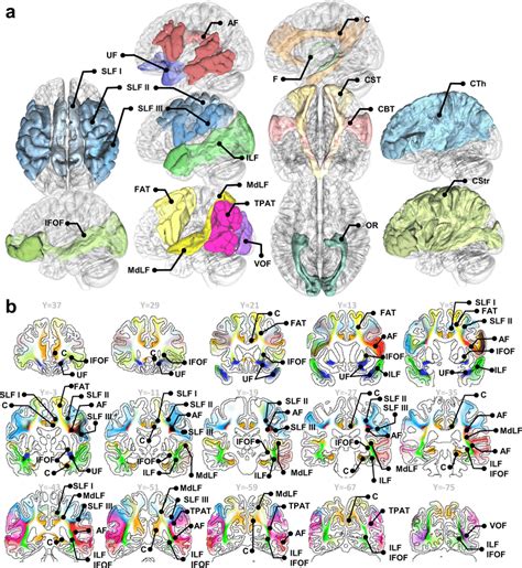 Overview Of The Population Based Tractography Atlas In 3d Rendering And
