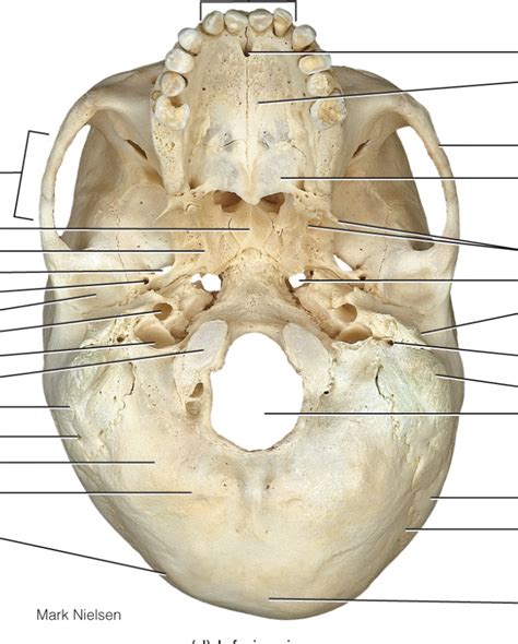 Diagram Of Occiput Pt 3 Quizlet