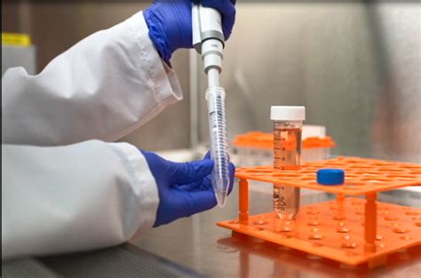 Pbmc Protocol Bruker Cellular Analysis