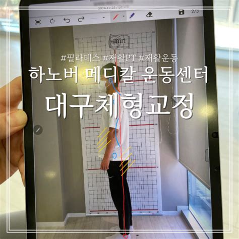 대구체형교정 하노버 메디칼 운동센터 And 재활pt 네이버 블로그