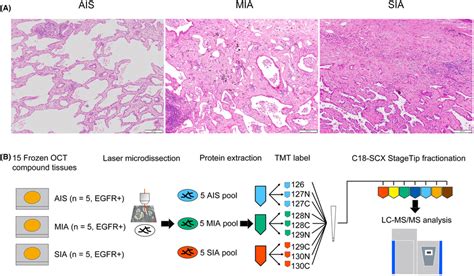 Workflow Of Quantitative Proteomics Analysis Of Small‐sized Lung