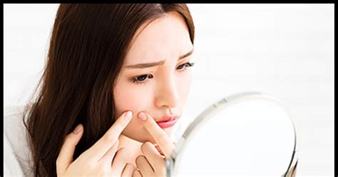 Get Complete Guide On How To Prevent Pimples Acne Forever