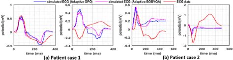 Real Data Experiments Comparison Of The Real Ecg Data And The