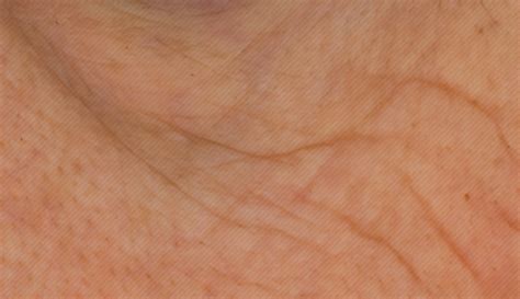 Female 067 Albedo Map