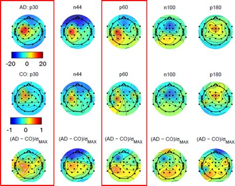 Topographic Distribution Of The Tms Evoked Activity Scalp Distribution Download Scientific