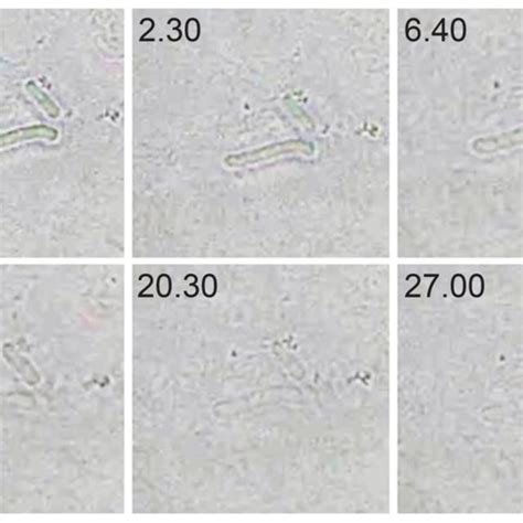 Optical Microscopy Of The Action Of Cwh351 656 On C Difficile Cells
